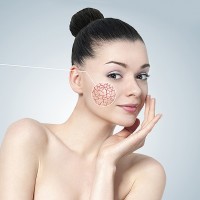 Couperosis laser treatment | Correct Cosmetology